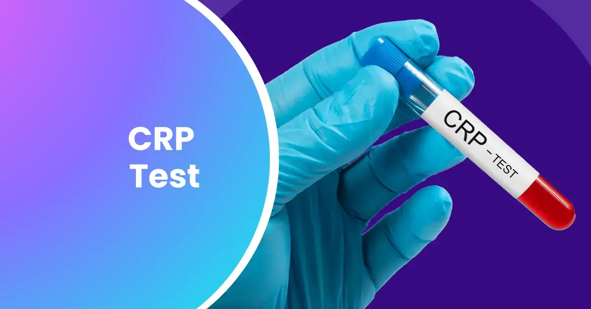 C-Reactive Protein (CRP) Test: - Medilife HealthCare Group